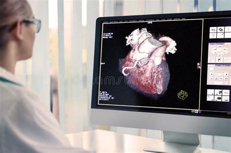 Digital Heart Scan On A Hospital Monitor Stock Image Image Of Signage Gadget 373493935