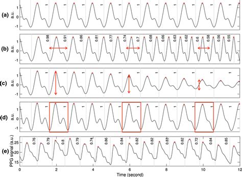 Stationary And Nonstationary At Terri Kent Blog