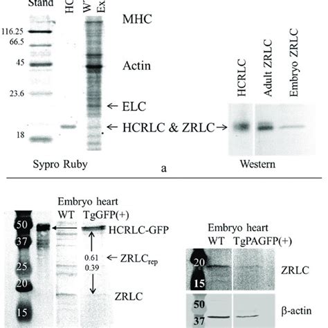 The Sypro Ruby Stained And Immunoblotted Sds Page Gels The Sypro Ruby Download Scientific