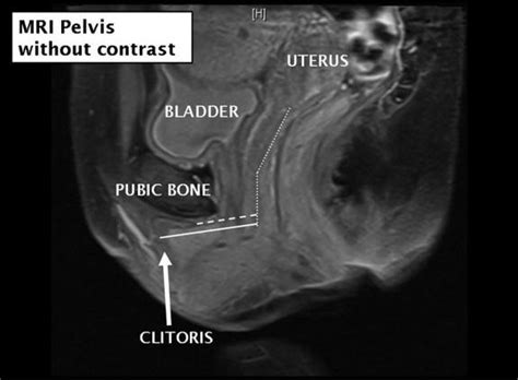 Research Has Found That Distance Between A Woman S Clitoris And Her Vaginal Opening Is