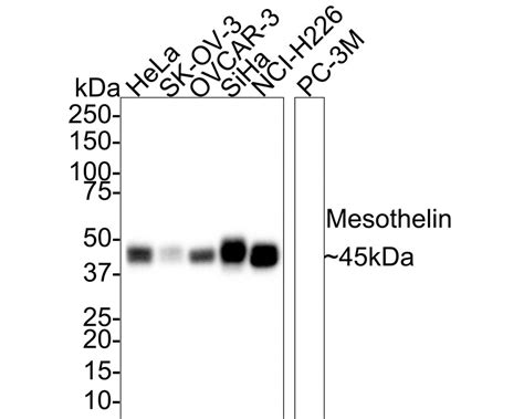 Mesothelin Recombinant Rabbit Monoclonal Antibody [psh0 57] Ha721404 Huabio