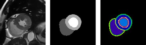 The Figure Shows The Spatial Weight Map Generated From The Ground Truth Download Scientific