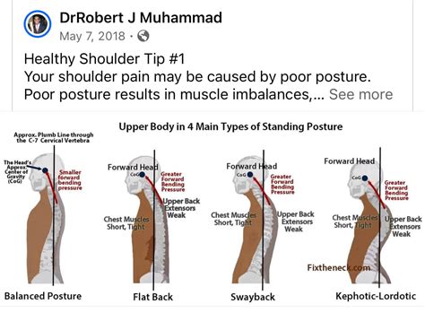 Midwest Back Center Of Midwest Back Center Of Chicago Midwest Back Center Of Midwest Back Center Of Chicago
