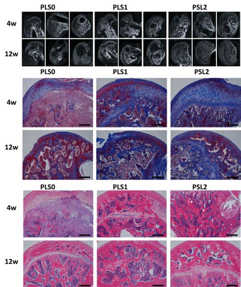 A Micro Ct Scans Of Psl0 Pls1 And Pls2 Groups After 4 And 12 Weeks