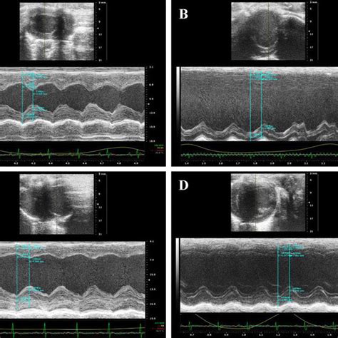 Cardiac Function Detected By Echocardiography A Normal Cardiac Download Scientific Diagram
