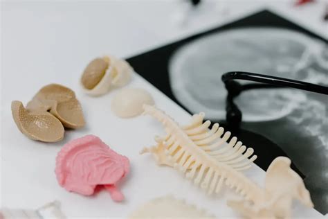 Icd 10 Pcs 0pnn4zz Release Left Carpal Percutaneous Endoscopic Approach