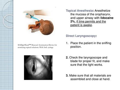 Ppt Airway Intubation Powerpoint Presentation Free Download Id2894259