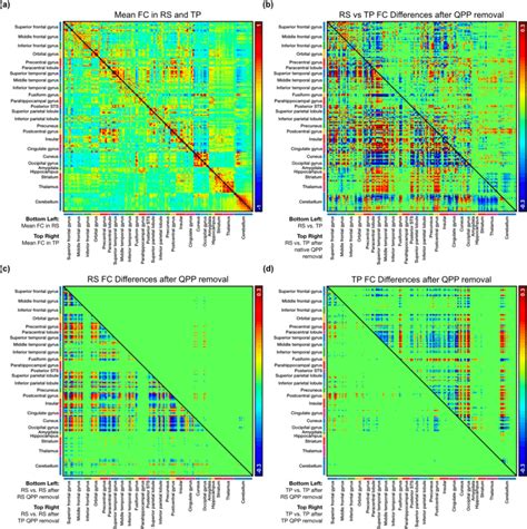 Functional Connectivity Fc In 273 Regions Of Interest A Download Scientific Diagram