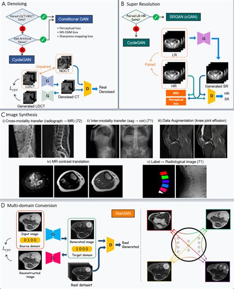 Deep Generative Adversarial Networks Applications In Musculoskeletal
