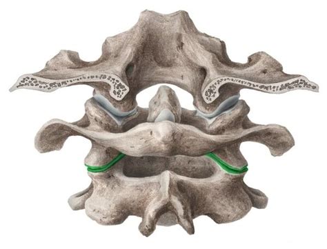 Atlanto Axial Joint Wikism Sports Medicine Wiki