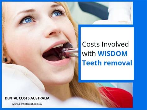 Reliable Information About Wisdom Teeth Removal Cost In Sydney