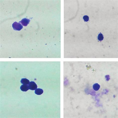 Microscopic Analysis Of K562 Cell Differentiation After 48 Hours A