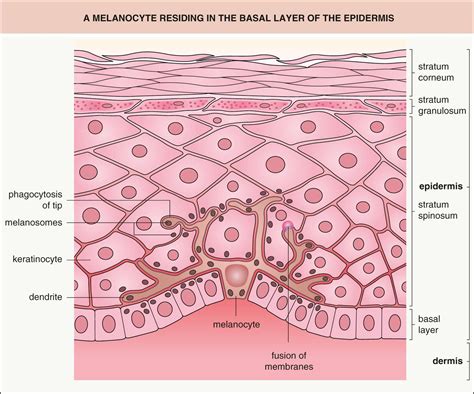 Melanocyte Biology Clinical Tree