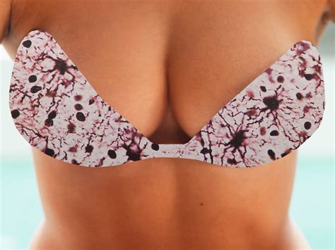 Breast Implants Have Been Linked To Rare Cancer