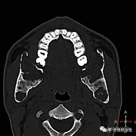 神奇的 大胡子征‘ 知乎