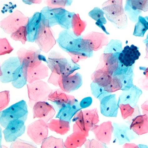 Images With Compression Artifacts Each Line Presents An Original