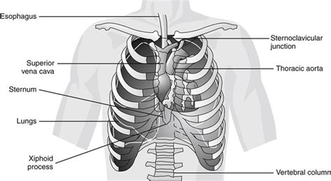 Xiphoid Process Skeletal Disorders Fractures Xiphoid Process Skeletal Disorders Fractures
