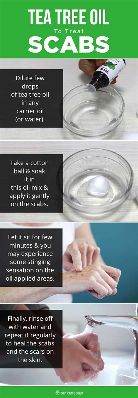 Natural Ways To Get Rid Of Scabs