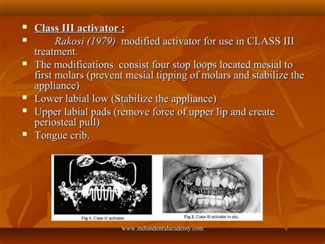 Early Correction Of Angles Class 3 Malocclusion Ppt