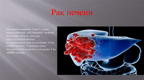Доброкачественные и злокачественные новообразования печени и желчного пузыря эпидемиология