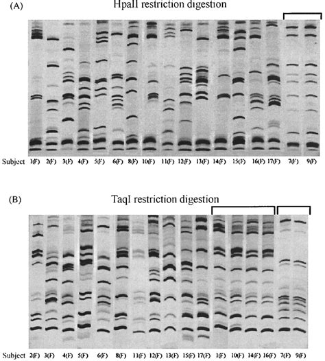 OPA Typing Of Strains From The Female Members Of 17 Sex Partnerships Download Scientific