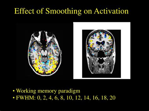Ppt Basics Of Fmri Preprocessing Powerpoint Presentation Free Download Id3944532