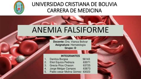 Anemia Falciforme Jorge Melgar Udocz