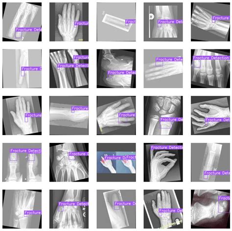 pyresearch on linkedin ai machinelearning deeplearning objectdetection paligemma pyresearch…