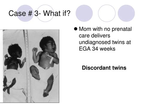 Ppt Intrauterine Growth Restriction Iugr Powerpoint Presentation
