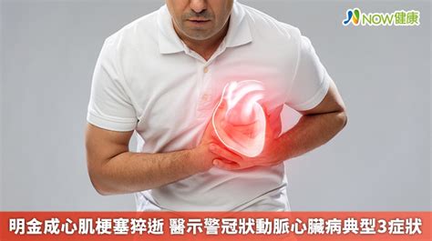 明金成心肌梗塞猝逝 醫示警冠狀動脈心臟病典型3症狀 蕃新聞