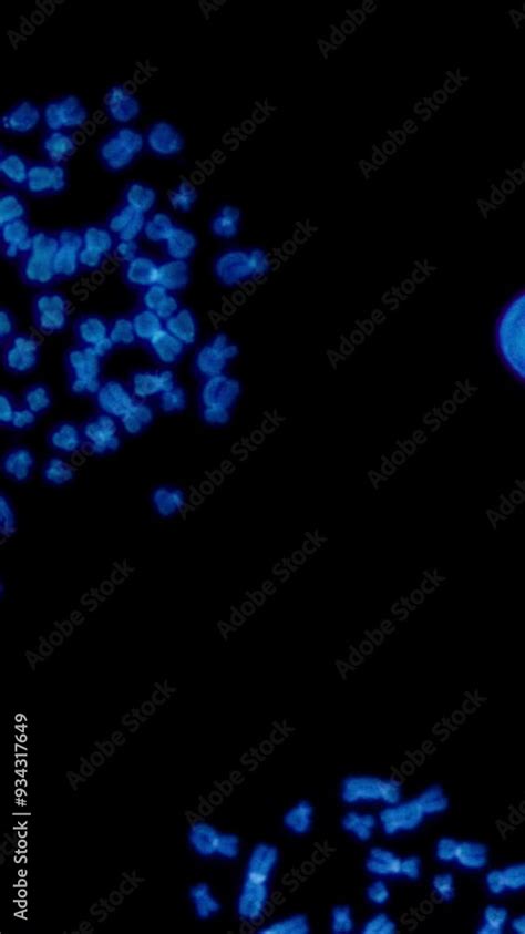 Chromosomes Under Fluorescence Microscope Fluorescence In Situ Hybridization Technique Human