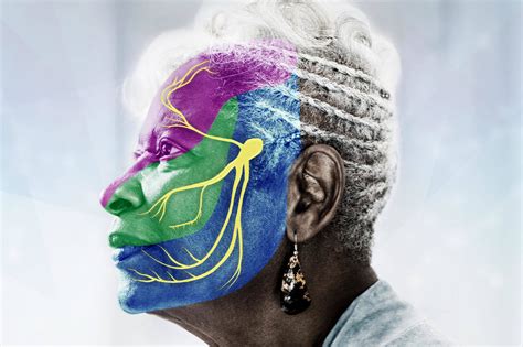 Trigeminal Neuralgia Differential Diagnosis And Treatment Strategies Clinical Advisor