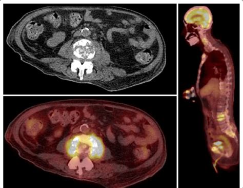 Pet Scan Ultrasound At Oliver Howell Price Blog