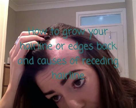 How To Grow Your Hairline Or Edges Back And Causes Of Thining Hairline