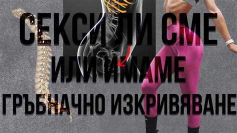 Секси ли сме или имаме гръбначно изкривяване Youtube