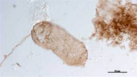 The Evolution Of Photosynthesis Better Documented Thanks To The