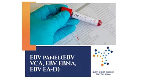 Ebv Panel Ebv Vca Ebv Ebna Ebv Ea D Abbaltis