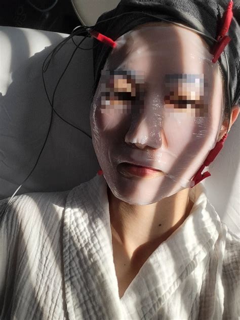 강남피부과에서 요즘 핫한 티타늄리프팅 받고 온 후기 1회로도 확연한 전후 사진⭕️ 효과⭕️ 네이버 블로그