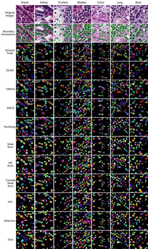 Visual Comparisons To Different Instance Segmentation Methods On Monuseg Download Scientific
