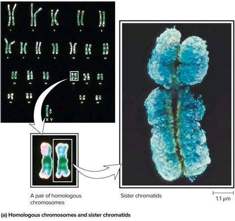 Hanaa Fayed On Linkedin Chromosomes Following Dna Replication ‼️ A The Photomicrograph On The…