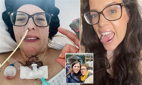 I Was Forced To Have 6cm Of My Tongue Cut Off After Doctors