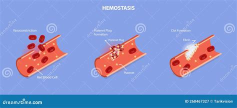 3d Isometric Flat Vector Conceptual Illustration Of Hemostasis Stock