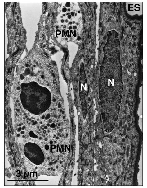 Transmission Electron Micrograph Showing Polymorphonuclear Leukocytes Download Scientific