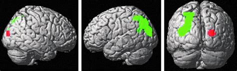 Sex Hormones Modulate The Relationship Between Global Advantage Lateralization And