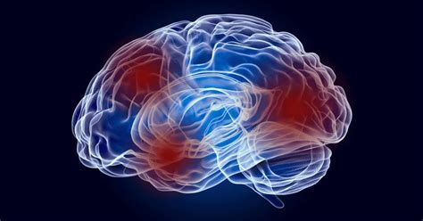 3 Main Causes Of Tinnitus Symptoms Triggers And Effective Treatment Options