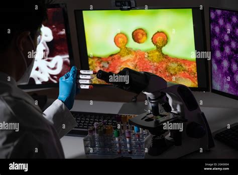 Blood Tests To Detect Sexually Transmitted Diseases Or STDs Hepatitis B And C Syphilis HIV