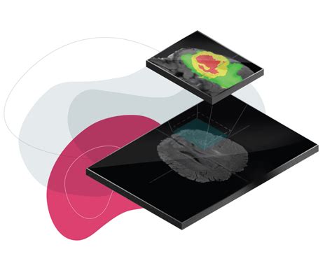 Medical Image Analysis Graylight Imaging