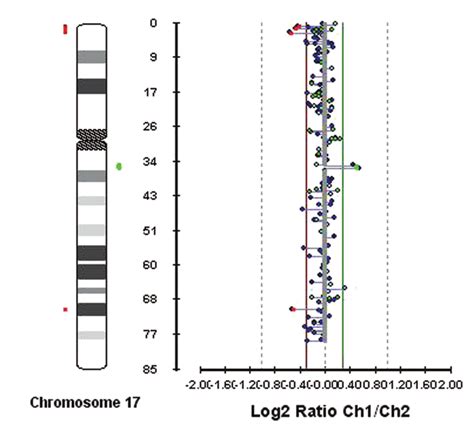 Array Cgh Analysis In Patient 3 Showing Significant Gain Of 17 Q12 Download Scientific