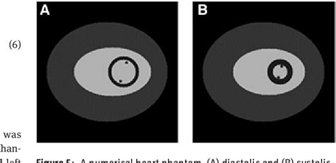 Figure 1 From A Kernel Method For Higher Temporal Resolution Mri Using The Partial Separability