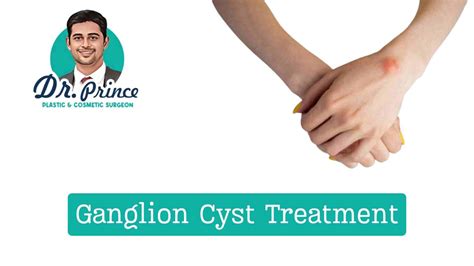 Ganglion Cyst Removal Topplasticsurgery